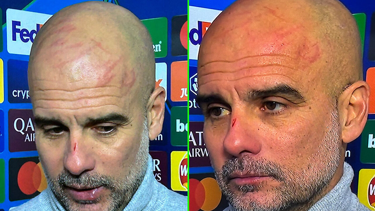 Opvallend beeld: gehavende Pep Guardiola verschijnt na wedstrijd met ...